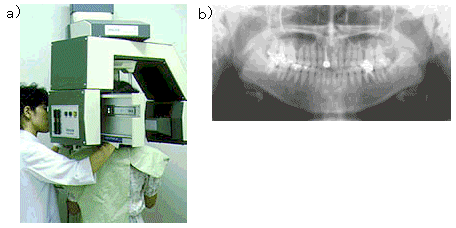歯科におけるX線撮影法と歯科用デジタルX線画像診断システム