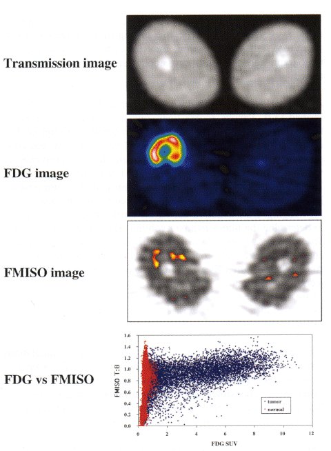 PET用腫瘍診断剤：F-18-フルオロミソニダゾル